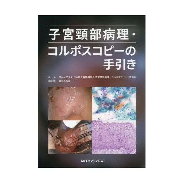 【発売日：2026年05月16日】日本婦人科腫瘍学会子宮頸部病理・コルポスコピー小委員会/編集 藤井多久磨/編集代表/子宮頸部病理・コルポスコピーの手引き、メディア：BOOK、発売日：2026/05、重量：500g、商品コード：NEOBK-...