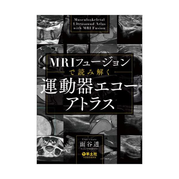 【発売日：2026年05月17日】面谷透/著/MRIフュージョンで読み解く運動器エコーアトラス、メディア：BOOK、発売日：2026/05、重量：500g、商品コード：NEOBK-3212521、JANコード/ISBNコード：9784758...