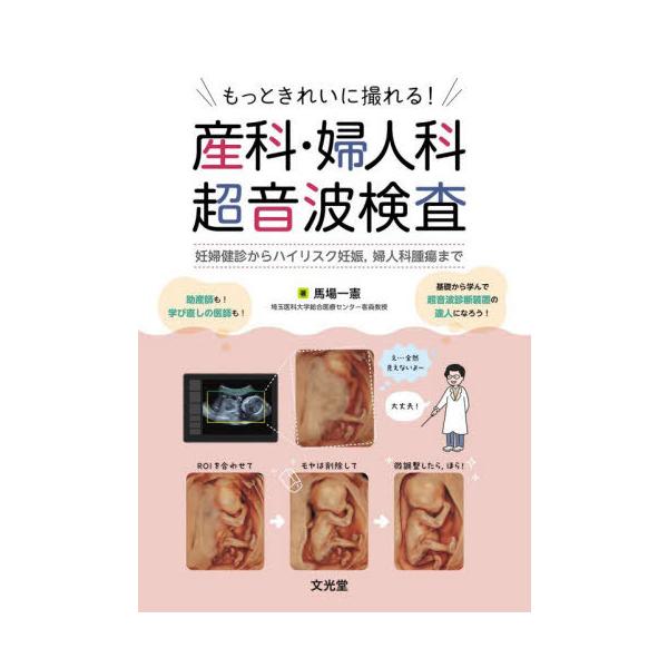 【発売日：2026年05月13日】馬場一憲/著/もっときれいに撮れる!産科・婦人科超音波、メディア：BOOK、発売日：2026/05、重量：500g、商品コード：NEOBK-3212788、JANコード/ISBNコード：9784830631283
