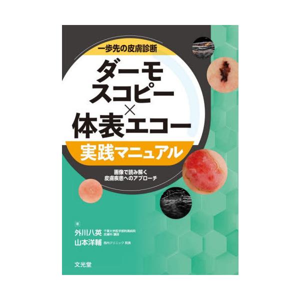 【発売日：2026年06月11日】外川八英/著 山本洋輔/著/ダーモスコピー×体表エコー実践マニュアル、メディア：BOOK、発売日：2026/06、重量：500g、商品コード：NEOBK-3221093、JANコード/ISBNコード：978...
