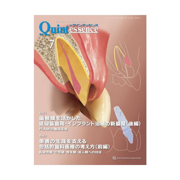 【発売日：2026年07月28日】クインテッセンス出版/ザ・クインテッセンス vol.45/no.7(2026JULY)、メディア：BOOK、発売日：2026/07、重量：500g、商品コード：NEOBK-3227595、JANコード/IS...