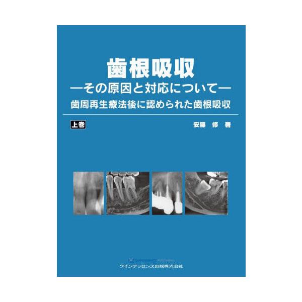 【発売日：2026年09月18日】安藤修/著/歯根吸収 その原因と対応について 上巻 歯周再生療法後に認められた歯根吸収、メディア：BOOK、発売日：2026/09、重量：500g、商品コード：NEOBK-3245129、JANコード/IS...