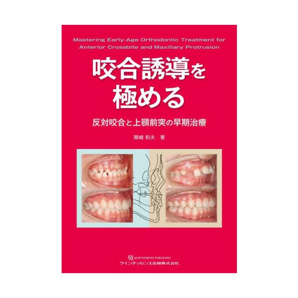【発売日：2026年10月09日】関崎和夫/著/咬合誘導を極める 反対咬合と上顎前突の早期治療、メディア：BOOK、発売日：2026/10、重量：500g、商品コード：NEOBK-3254606、JANコード/ISBNコード：9784781...