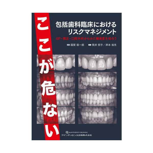 【発売日：2026年10月09日】国賀就一郎/編著 筒井照子/著 岸本裕充/著/ここが危ない包括歯科臨床におけるリスクマネジメント GP・矯正・口腔外科からみた難易度を知ろう、メディア：BOOK、発売日：2026/10、重量：500g、商品...