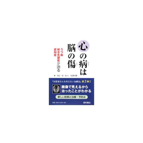 うつ病、統合失調症、認知症など、心の病気の原因を突き止め、治療法を確立。経験に基づく画期的な診断法とともに、その治療法を解説する。■カテゴリ：中古本■ジャンル：スポーツ・健康・医療 医療■出版社：西村書店■出版社シリーズ：■本のサイズ：単行...