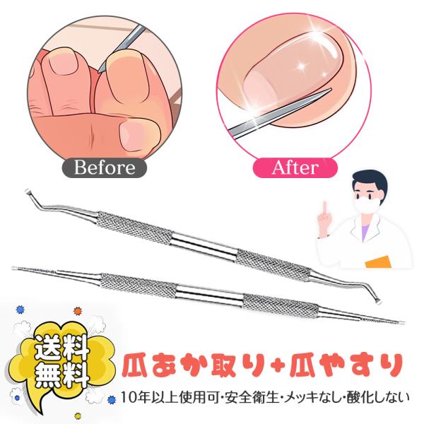 商品仕様■素材：ステンレススチール■サイズ：14x0.5cm■ パッケージ：爪やすり、爪垢取り2点セット専用収納ケース付きで持ち運びに便利！■重量：約10g/2点セット■生産地：China使用用途※ステンレス製で清潔感があります。爪やすりの...