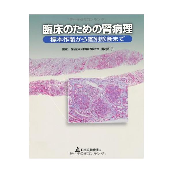 【商品概要】【商品説明】【商品詳細】ブランド：日本医事新報社商品種別：本商品名：臨床のための腎病理標本作製から鑑別診断まで製造元：日本醫事新報社【当店からの連絡】