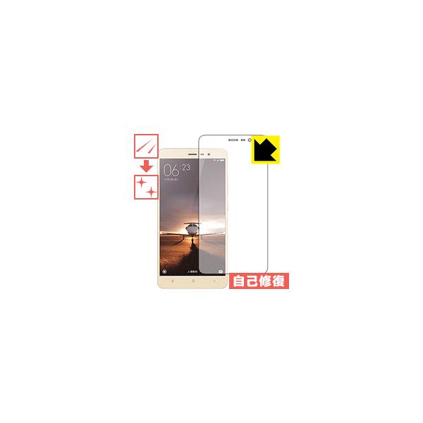【自己修復タイプ(光沢)】液晶保護フィルム(保護シート)※対応機種 : Xiaomi Redmi Note 3 Pro【ポスト投函発送の場合のみ送料無料(代金引換は送料無料になりません)】