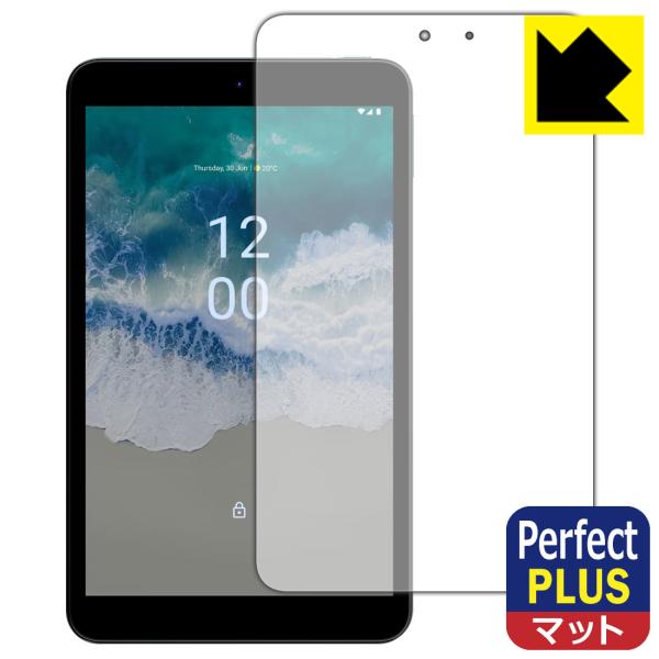 【アンチグレアタイプ(非光沢)】保護フィルム(保護シート)※対応機種 : Nokia T10専用の商品です。※製品内容 : 画面用フィルム1枚・クリーニングワイプ1個【ポスト投函発送の場合のみ送料無料(代金引換は送料無料になりません)】