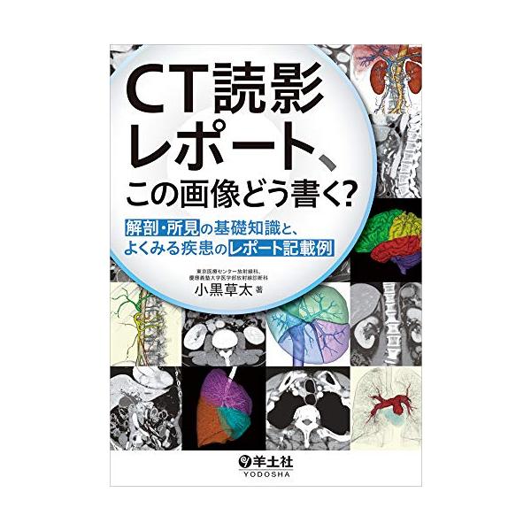 CT読影レポートの実例満載の入門書．解剖をふまえた読影のポイントや，具体的なレポート記載方法を，ベスト指導医賞を受賞した著者がわかりやすく教えます！放射線科研修で初めに知りたい知識がつまった１冊です．  【目次】 1章　読影レポートを書く前...