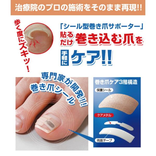 治療院のプロの施術をそのまま再現「シール型サポーター」貼るだけで巻き込む爪を手軽にケア！！適度な弾力で形状を保ち続ける「ケアメタル」がサポート。本商品は巻き爪の治療院の施術を基に開発された商品です。平らな形状を保ち続けるケアメタルを爪の上に...
