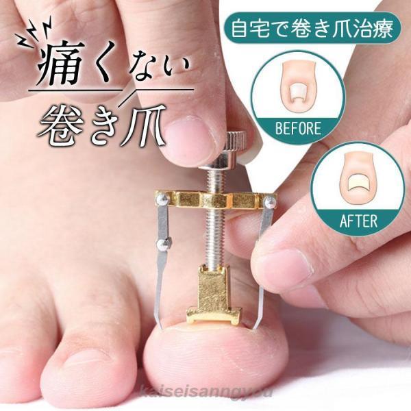 商品詳細:カラー:/シルバーサイズ:/フリーサイズ■商品説明・痛くない自分でできる・加工不要の新しい巻き爪・陥入爪の矯正治療・折り曲げ・接着などの加工がなく耐久性あり■素材ステンレス製■注意事項※巻き爪の程度がひどい場合には使用できません。...