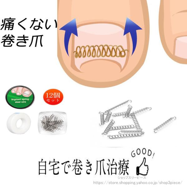 商品詳細:カラー:/画像通りサイズ:/F■商品説明セット内容:矯正チエーン2組セット（1組6個、共12個）サイズ:全6サイズ（1.2cm、1.6cm、 1.8cm 、2.0cm、2.4cm、2.6cm）・痛くない！自分でできる！・加工不要の...