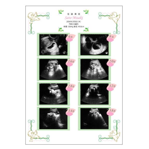 【ご注文からお手元に届くまで】1.ご注文後、ヤフーより自動注文受付メールが届きます2.さらに担当者より、エコー写真の発送先等お手元に届くまでの流れを記載した確認メールが届きます。3.お客様よりエコー写真の発送又は送信。（お写真の発送代金、送...