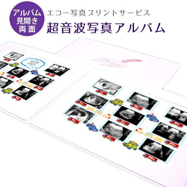 [超音波写真アルバム★スペシャル]お写真がたっぷり17枚はいる見開き台紙付きのスペシャルタイプです。超音波写真がたくさんある方、出産後のお写真や手形・足形なども一緒にアルバムにしたい方にオススメです。★スペシャル・内容☆お写真の枚数　17枚...