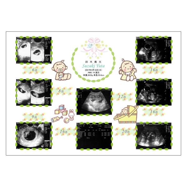 【ご注文からお手元に届くまで】1.ご注文後、ヤフーより自動注文受付メールが届きます2.さらに担当者より、エコー写真の発送先等お手元に届くまでの流れを記載した確認メールが届きます。3.お客様よりエコー写真の発送又は送信。（お写真の発送代金、送...