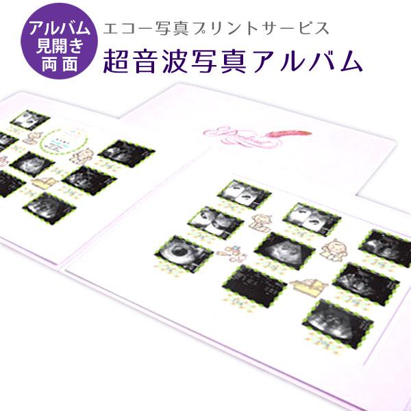 [超音波写真アルバム★スペシャル]お写真がたっぷり17枚はいる見開き台紙付きのスペシャルタイプです。超音波写真がたくさんある方、出産後のお写真や手形・足形なども一緒にアルバムにしたい方にオススメです。★スペシャル・内容☆お写真の枚数　17枚...