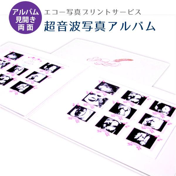 [超音波写真アルバム★スペシャル]お写真がたっぷり17枚はいる見開き台紙付きのスペシャルタイプです。超音波写真がたくさんある方、出産後のお写真や手形・足形なども一緒にアルバムにしたい方にオススメです。★スペシャル・内容☆お写真の枚数　17枚...