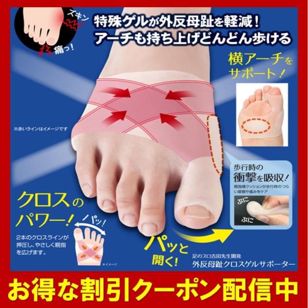 特殊ゲルが外反母趾を軽減！アーチも持ち上げどんどん歩ける。★クロスラインが親指をやさしく広げ、さらに親指横クッションが付け根のつらい摩擦や痛みをケアします。　同時に足裏のクッションが弛んだ横アーチを支え、足の負担を軽減します。●クロスのパワ...