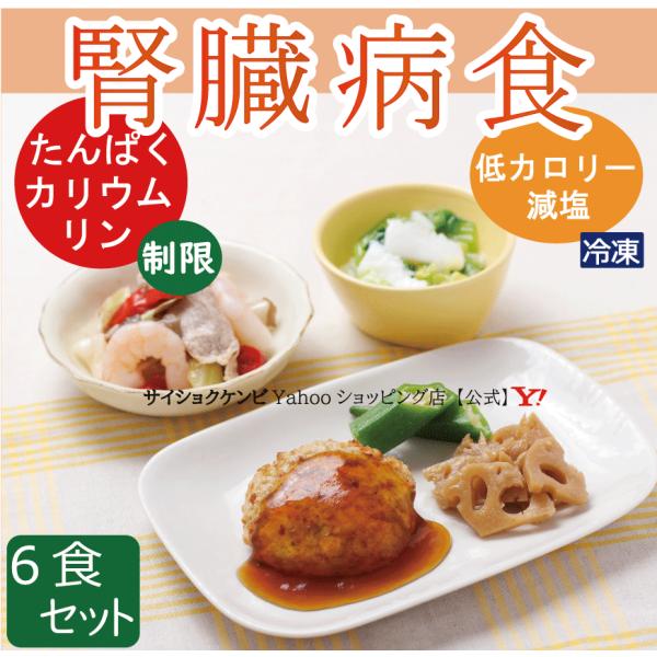 【腎臓病食 (商品名：たんぱく調整食9g) たんぱく質：9g カロリー：300Kcal 糖質：28g 塩分：1.7g 脂質：17g カリウム：500mg リン：200mg】＊一食あたりの成分表 (カロリーは ±10％以内です)腎臓病の方向け...
