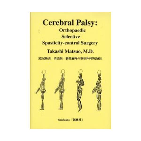 本 ISBN:9784883520213 松尾隆／著 出版社:創風社 出版年月:2001年11月 サイズ:446P 23cm 医学 ≫ 臨床医学内科系 [ 小児科学一般 ] ノウセイ マヒ ノ セイケイ ゲカテキ チリヨウ セリブラル ポル...