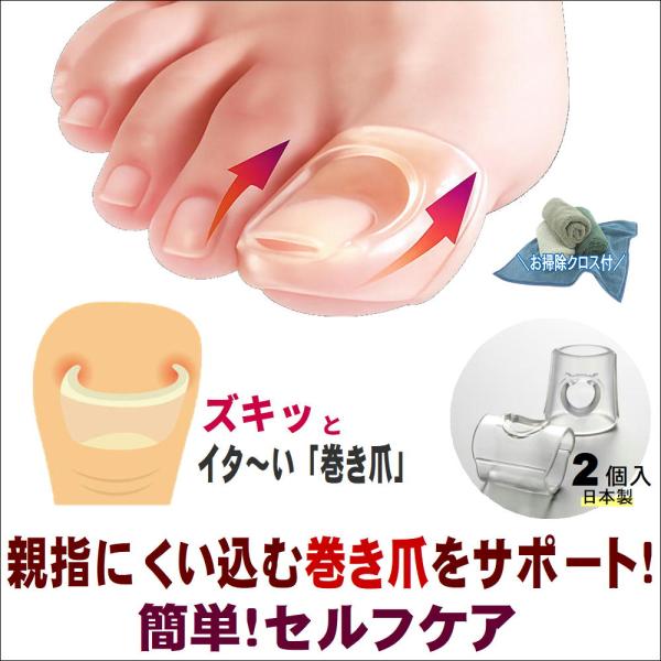 爆買 巻き爪ゲルエイド+お掃除クロス1枚付でのお届になります。（お掃除クロスのカラーはランダムでお届けします。）カンタン巻き爪ケア!親指にくい込んだ「巻き爪」の痛みに。指の肉の爪がどんどん喰い込み、痛みを起こす巻き爪。〜そんなお悩みに〜衝撃...