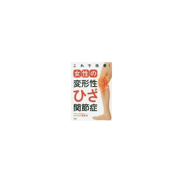 商品名：中古単行本(実用) ≪医学≫ これで改善!女性の変形性ひざ関節症 医学