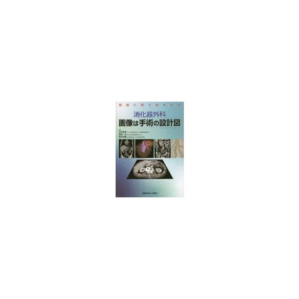 商品名：中古単行本(実用) ≪医学≫ 消化器外科画像は手術の設計図 術前に見ておきたい医学