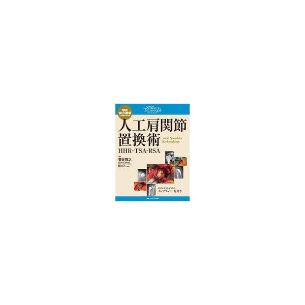 商品名：中古単行本(実用) ≪医学≫ 人工肩関節置換術  / 菅谷啓之医学【内容紹介】リバース型人工肩関節をはじめ情報のアップデートが進む「人工肩関節」の最新の実践テキスト。写真、シェーマでわかりやすく解説するとともに、WEB動画で実際の手...