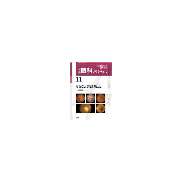 商品名：中古単行本(実用) ≪医学≫ まるごと黄斑疾患 (新篇眼科プラクティス 11)  / 辻川明孝医学【内容紹介】【眼科診療のスタンダードをビジュアルに解説！ 実践的シリーズの決定版!!】本書は，多種多様で難しいといわれる「黄斑疾患」に...