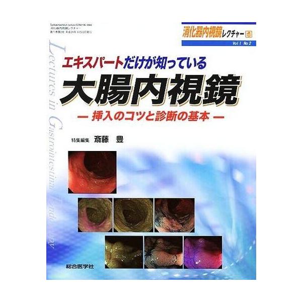 商品名：中古単行本(実用) ≪科学・自然≫ エキスパートだけが知っている大腸内視鏡 / 斎藤豊科学・自然消化器内視鏡レクチャー 1- 2