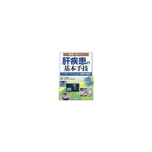 商品名：中古単行本(実用) ≪科学・自然≫ 動画で身につく肝疾患の基本手技 DVD付 / 小池和彦科学・自然