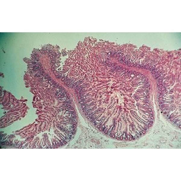 ●動物の体の様々な組織の構造を観察できます。＜仕様＞型式：20Pセット内容（20種各1枚）：小腸　大腸　心臓　腎臓　胃　肝臓　脊髄　血球　精子　卵巣　甲状腺　リンパ節　ニューロン等　ケース入入数：1セット