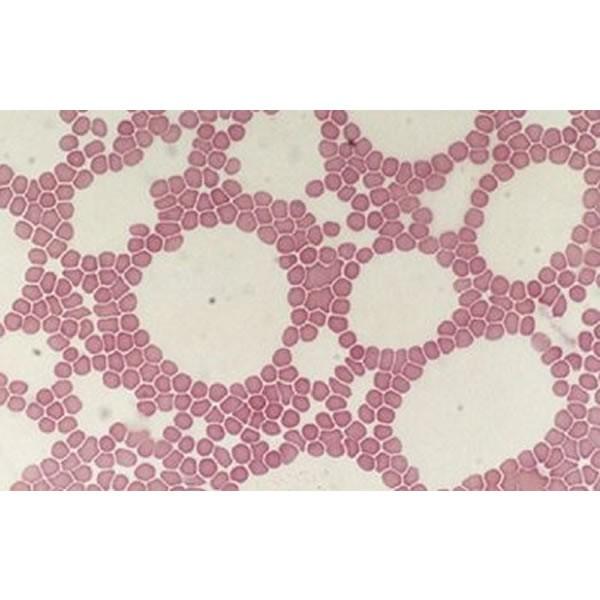 ●ヒトの各血液型の血球を観察できます。●4種の血液型がそれぞれ抗A血清・抗B血清による凝集状態を示しています。＜仕様＞型式：4Pセット内容：A型　B型　AB型　O型の標準血液　各1枚　ケース入入数：1セット