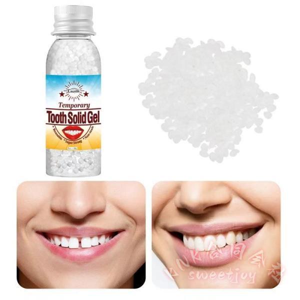 フィッティングビーズ、超便利、簡単操作。様々な形の歯を作ることができます。