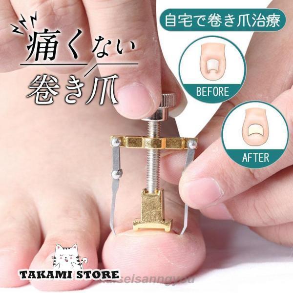 爆買 商品詳細:カラー:/シルバーサイズ:/フリーサイズ■商品説明・痛くない自分でできる・加工不要の新しい巻き爪・陥入爪の矯正治療・折り曲げ・接着などの加工がなく耐久性あり■素材ステンレス製■注意事項※巻き爪の程度がひどい場合には使用できま...