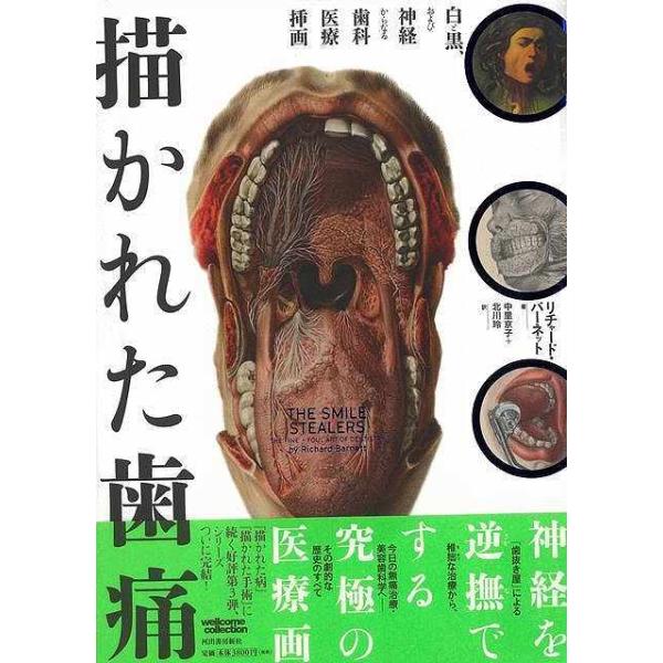 激痛を伴う「歯抜き屋」の稚拙な抜歯から無痛治療・美容歯科へと至る歯科治療の進化。ゾッとするが惹きつけられてしまう手法や器具の数々……衝撃の医学博物誌シリーズ、ついに完結！