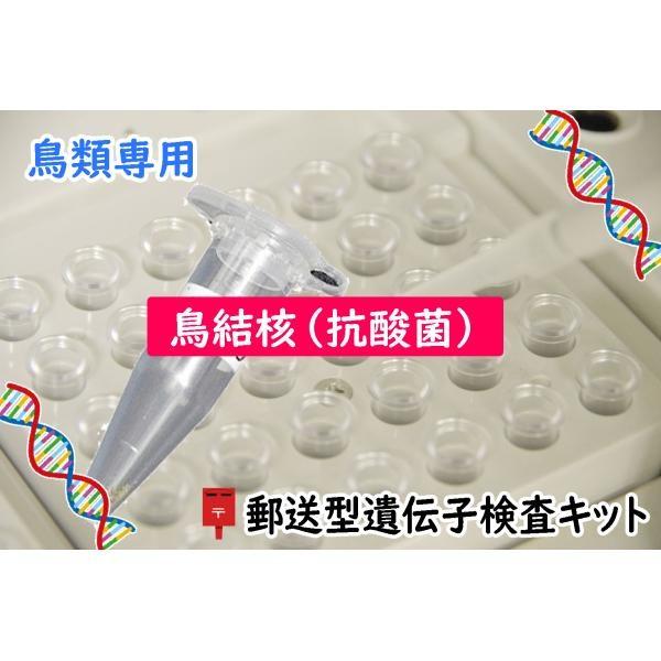 ●1キットにつき1羽の検査可能です●検査キットには有効期限があります（約1ヶ月）愛鳥の糞便を採取して郵送するだけで遺伝子検査を簡単に受けることができます結果は検体受領日から10日以内にEメールでご連絡（書面OK）検出方法　遺伝子検査法(PC...