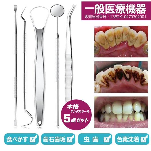 本製品は日本厚生労働省で★一般医療機器★として登録されています。登録番号：13B2X10479302001●プロも使う自宅用 本格デンタルツール5点セット。初心者にも安全安心の高級ステンレス製。お家で本格デンタルケア！歯石や汚れを簡単チェッ...