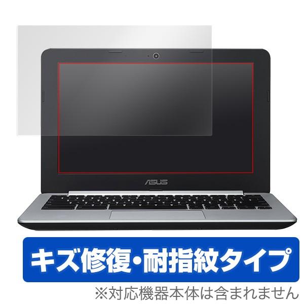 【発売日：2018年02月07日】ポイント利用ASUS Chromebook C202SA / C200MAに対応したシート表面の擦り傷を修復するタイプの液晶保護シート OverLay Magic(オーバーレイ マジック)！液晶画面の汚れや...