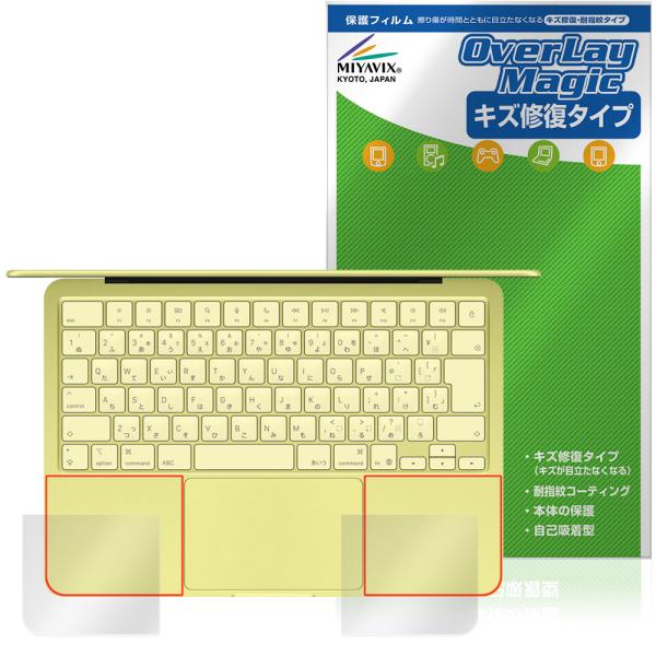 アップル「MacBook Neo A18 Pro (2026年3月発表モデル)」に対応したパームレスト用保護シート！シート表面の擦り傷を修復する素材を使用した OverLay Magic(オーバーレイ マジック)！パームレストの汚れやキズ付...