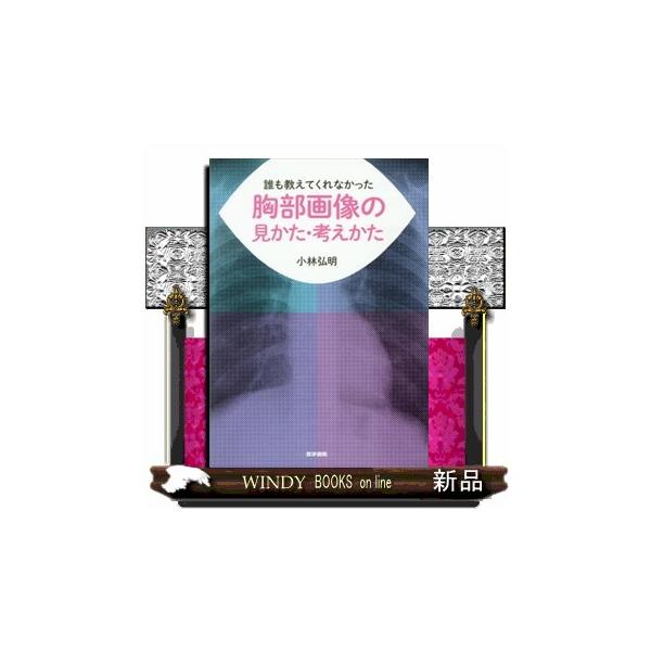 一生ものの読影力を身につけたいあなたへ贈る見えかたのメカニズムから理解する目からウロコの胸部画像診断の入門書がついに登場！　X線写真に映る影や線は，なぜ見えるのか？　その原理がわかれば，病変の存在や部位を推定することができる。本書では，従来...