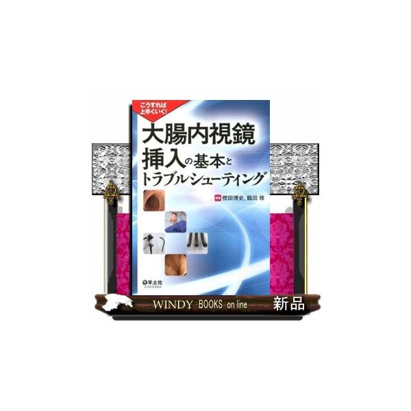 アングル操作・体位変換・スコープの使い分けなどの必須手技が身につく。肛門から盲腸まで、挿入のポイント・攻略法が部位ごとによくわかる。痩せている・太っている・便秘がひどい…被検者の特徴に応じたコツも満載。１つのトラブルに対し、２人のエキスパー...