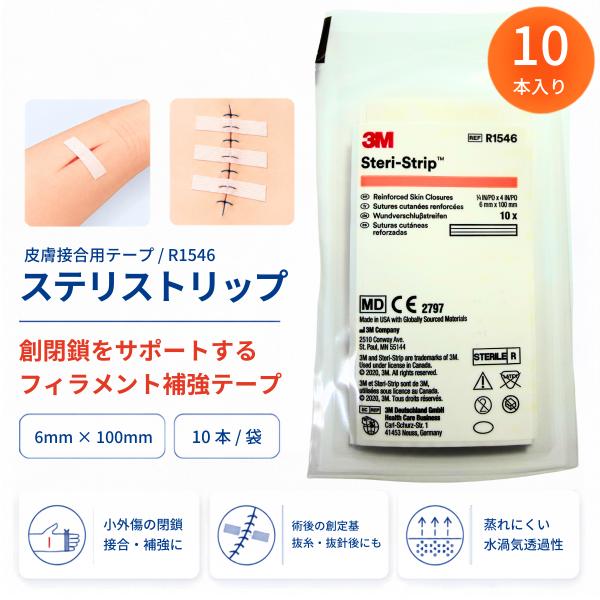 3M Steri-Strip ステリストリップ スキンクロージャー  R1546皮膚接合用テープ ・小外傷の閉鎖・接合・補強・手術創の閉鎖・接合・補強・抜糸・抜針後の固定・蒸れにくい水渦気透過性・サイズ ： 6mm × 100mm・入数 ：...