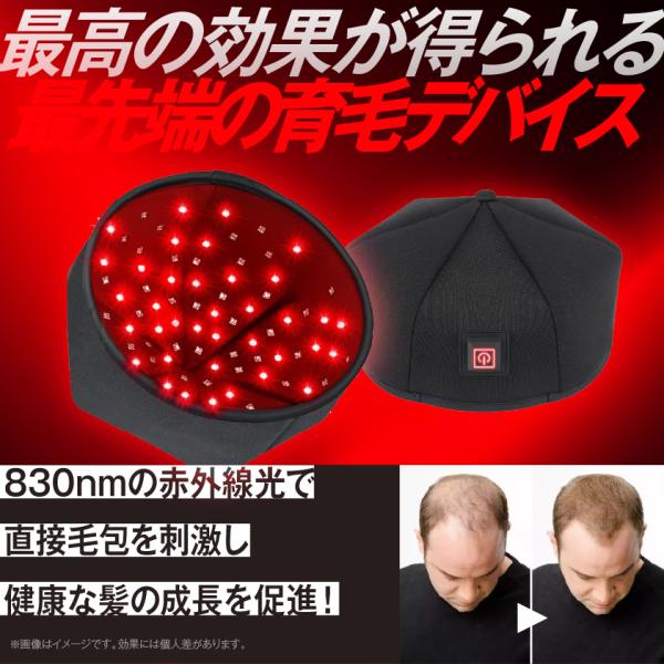 カズレーザーの番組でも紹介されました。LEDによる育毛・増毛の効果。LED育毛ライト内蔵帽子です。