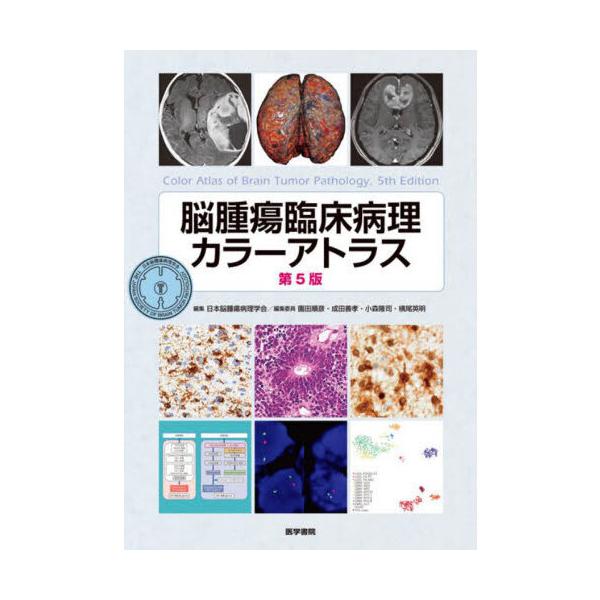 品名:脳腫瘍臨床病理カラーアトラス 第５版出版社:医学書院著者:日本脳腫瘍病理学会 園田順彦 成田善孝発売日:2024/5/15価格:22000円(税込)判型:Ａ４ISBN:9784260053297キーワード:ノウ シュヨウ リンショウ ...