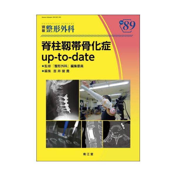 品名:脊柱靱帯骨化症ｕｐ-ｔｏ-ｄａｔｅ出版社:南江堂著者:吉井俊貴発売日:2026/4/25価格:7920円(税込)判型:Ａ４ISBN:9784524277896キーワード:セキチュウ ジンタイ コッカショウ アップ トゥ デート/吉井俊...
