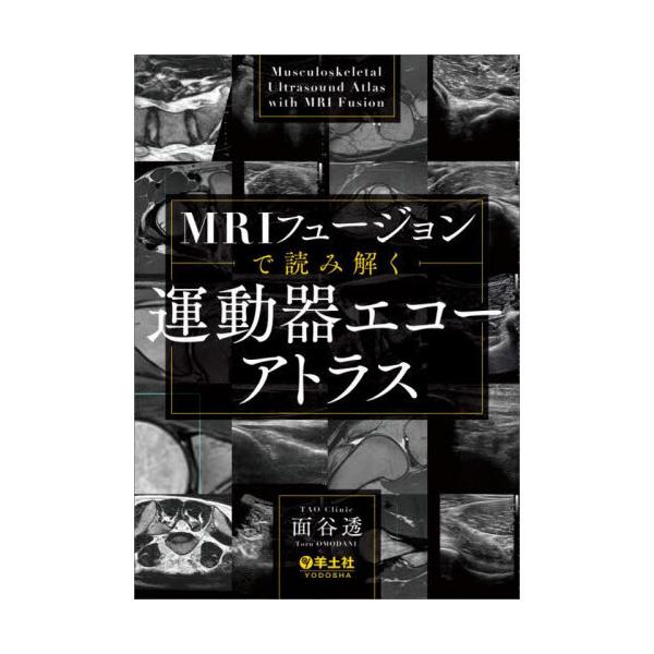 品名:ＭＲＩフュージョンで読み解く運動器エコーアトラス出版社:羊土社著者:面谷透発売日:2026/6/1価格:7920円(税込)判型:Ｂ５ISBN:9784758112710キーワード:エムアールアイ フュージョン デ ヨミトク ウンドウキ...