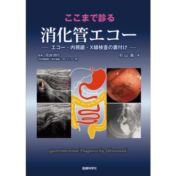 品名:ここまで診る消化管エコー出版社:医療科学社著者:杉山高発売日:2013/11/1価格:9570円(税込)判型:Ｂ5ISBN:9784860034436キーワード:ココマデミル ショウカカンエコー/杉山高/