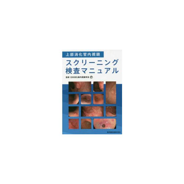 品名:上部消化管内視鏡スクリー二ング検査マニュアル出版社:医学図書出版著者:日本消化器内視鏡学会発売日:2017/5/10価格:5280円(税込)判型:Ａ４ISBN:9784865172164キーワード:ジョウブ ショウカカン ナイシキョウ...